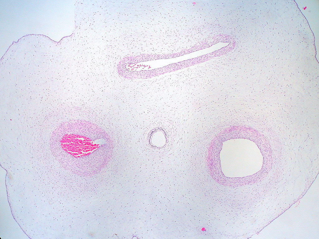 Umbilical Cord