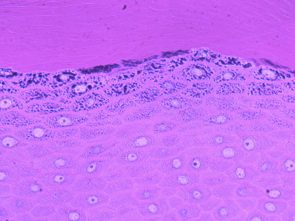 Stratum Granulosum And Stratum Corneum