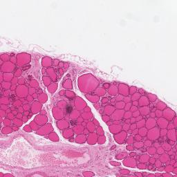 Yale Histology Connecticut DPH Extends COVID Testing Partnership With