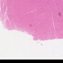 Histology at Yale Virtual Microscope