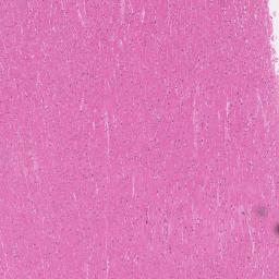 Histology at Yale Virtual Microscope