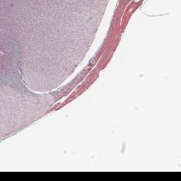 Histology at Yale Virtual Microscope