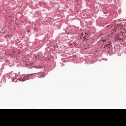 Histology at Yale Virtual Microscope